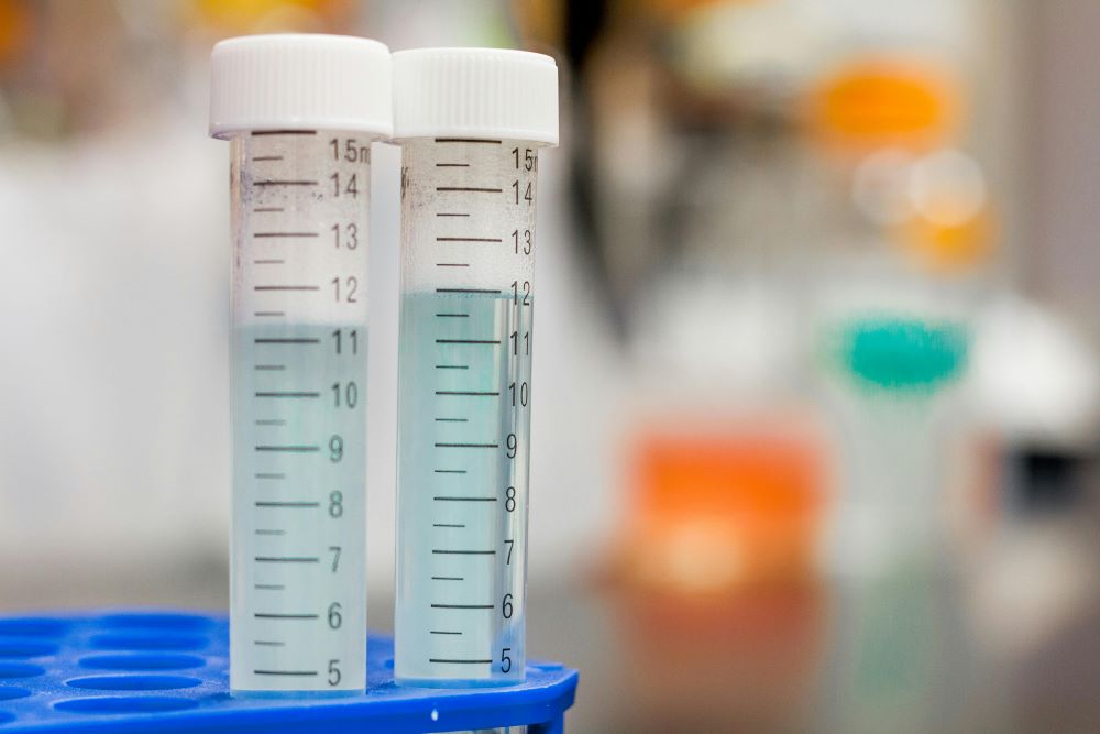 How Long Does Ketamine Stay in Your System? | Acquiesce